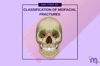 Classification of Midfacial Fractures: Systems and Exam Tips – Medi ...