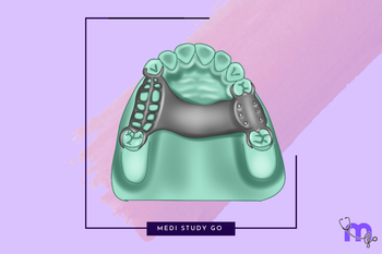 Major Connectors in Removable Partial Dentures: A Comprehensive Guide ...
