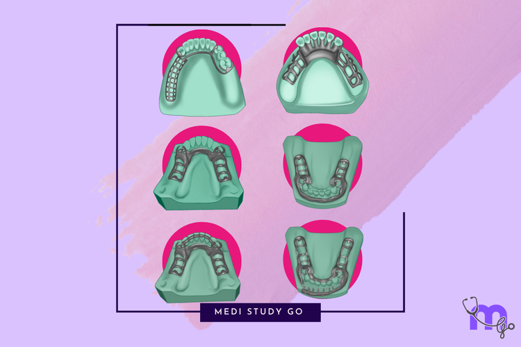 Mandibular Major Connectors: Complete Design Guide – Medi Study Go